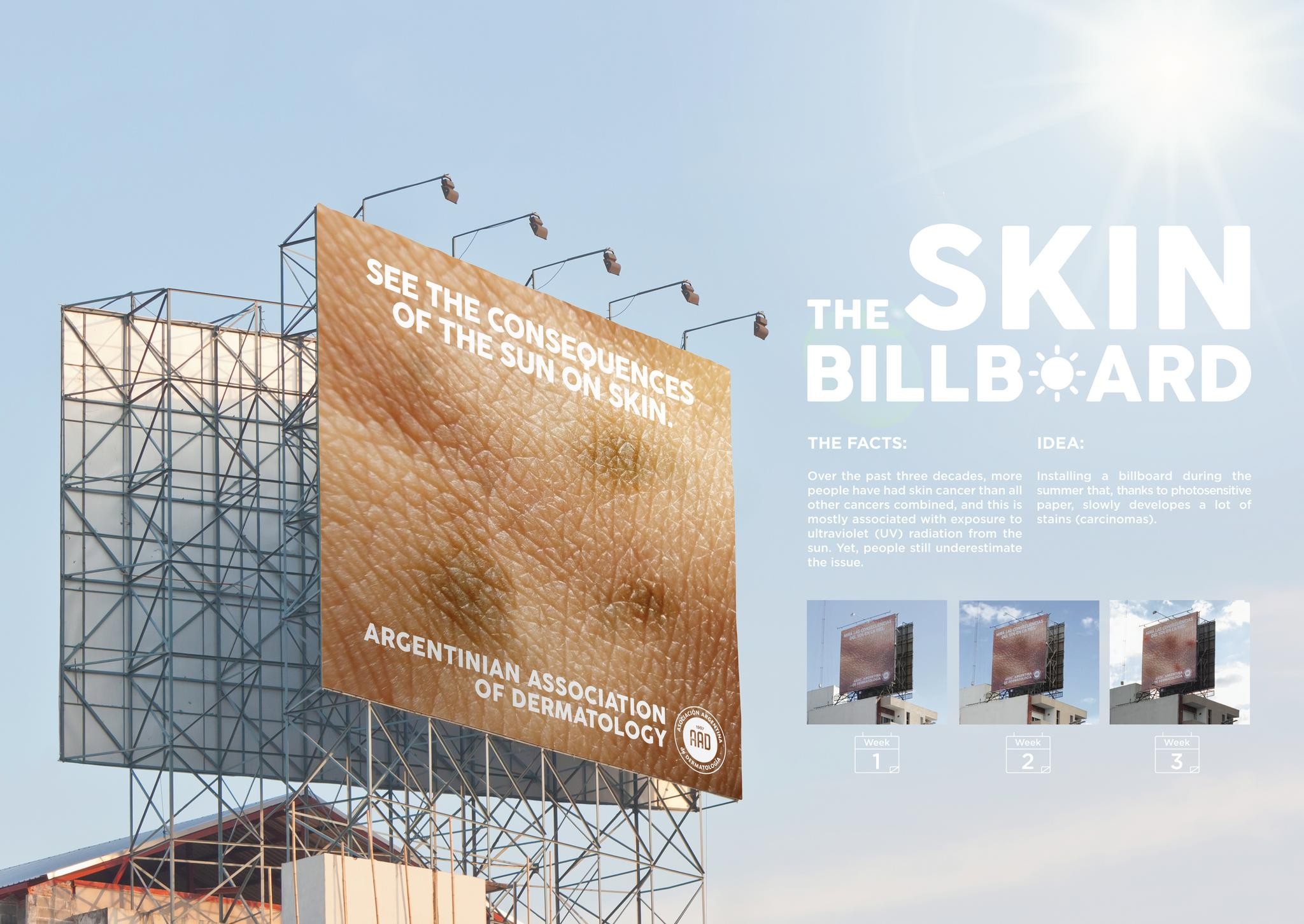 The Skin Billboard | Campaign | THE WORK