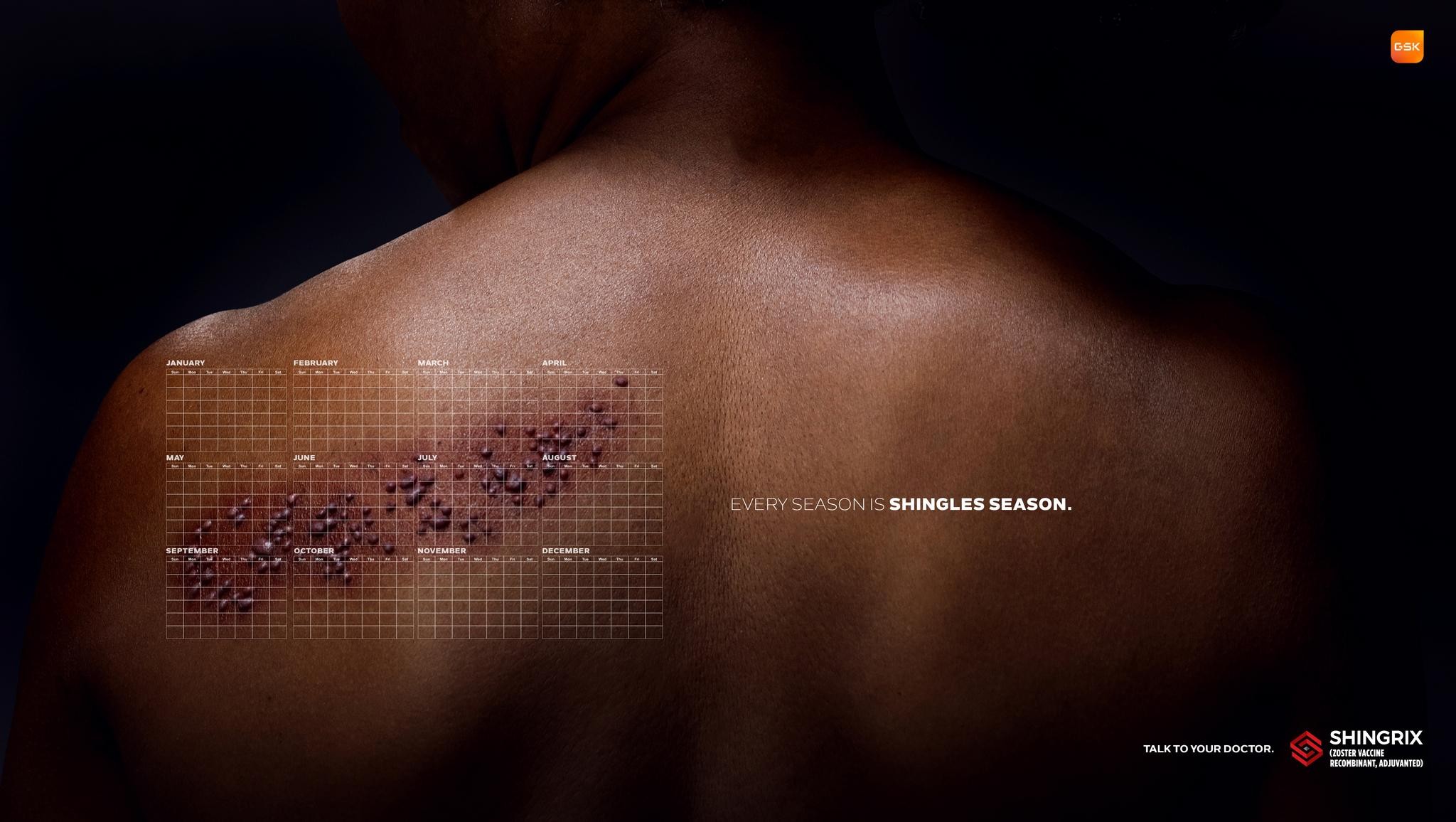 Shingles Season | Campaign