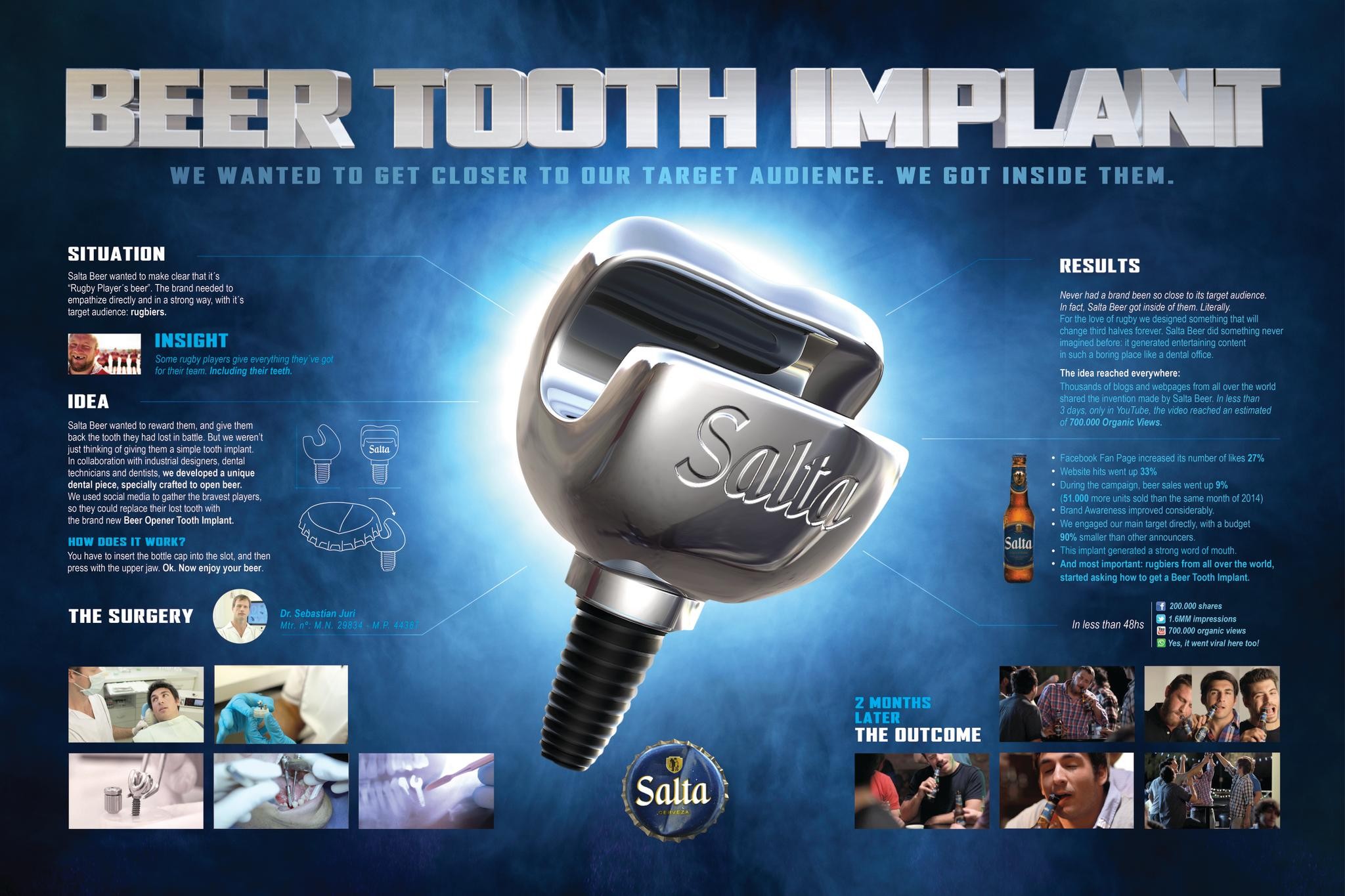 BEER TOOTH IMPLANT | Campaign | THE WORK