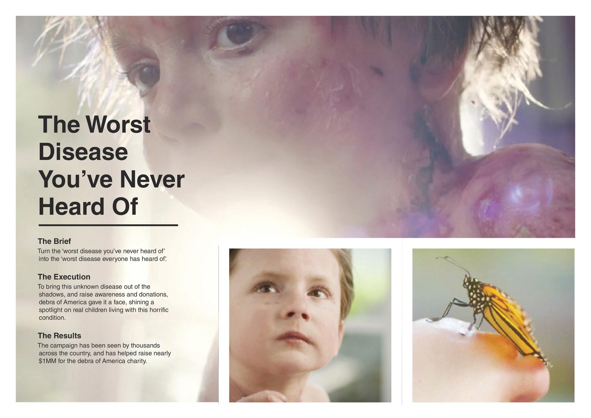 The Worst Disease You’ve Never Heard Of | Campaign | THE WORK