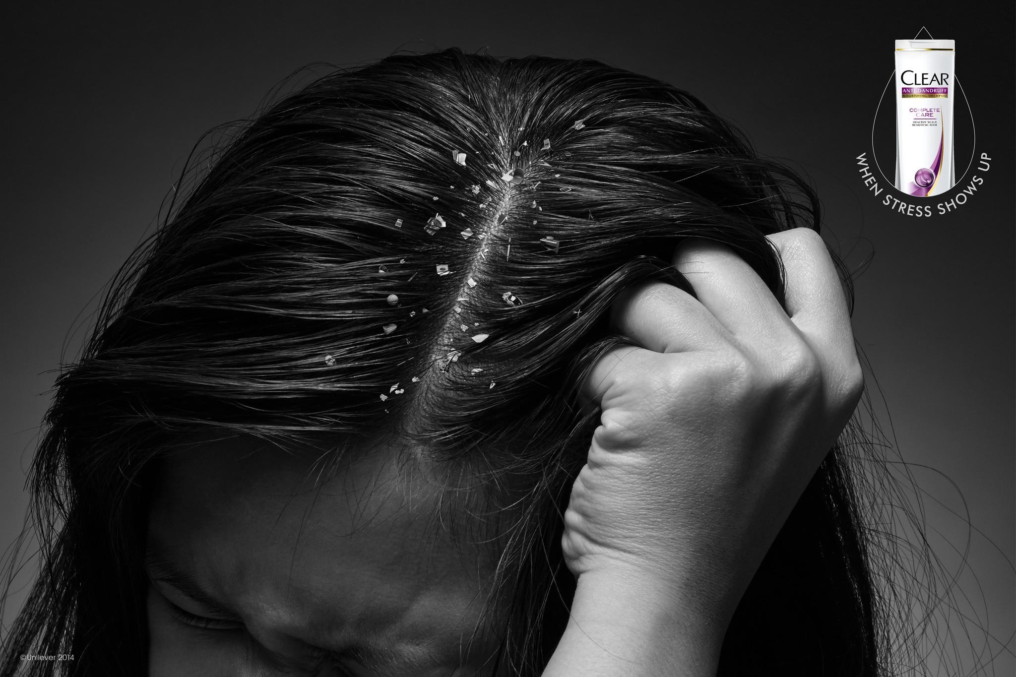 CLEAR ANTI-DANDRUFF SHAMPOO | Campaign | THE WORK